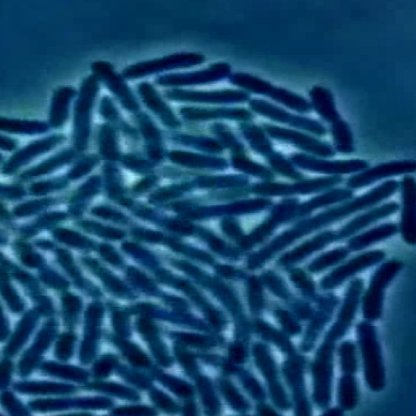 Press Release | FRONTLINE Investigates the Growing Superbug Crisis ...