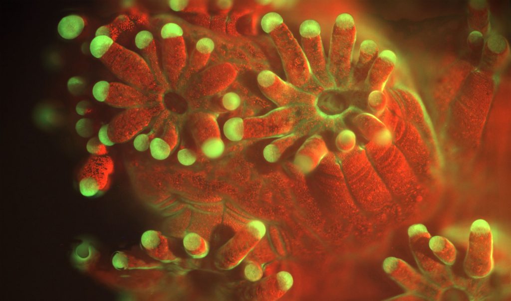 Images Under Microscope New Malignant Melanoma Treatments Show Promise