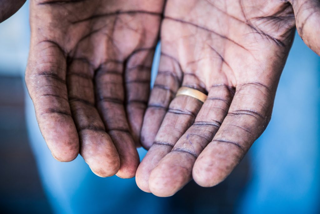 Effects Of Heroin Faces