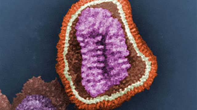 Influenza 1918: Teacher's Guide | American Experience | Official Site | PBS
