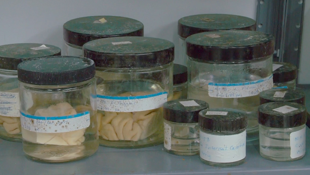 Albert Einsteins Brain In Jar In Search Of Einstein's Brain Big