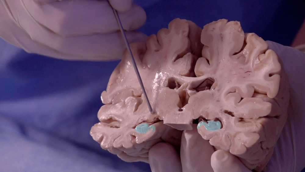 NOVA - Official Website | Memory vs. Intelligence