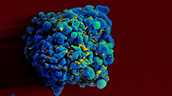 How a select few people have been cured of HIV | NOVA | PBS