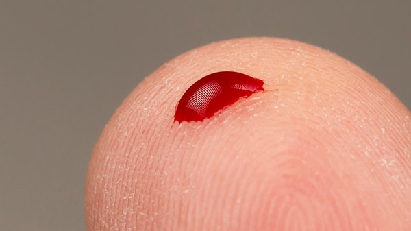 One Drop Of Blood Can Reveal Almost Every Virus A Person Has Ever Had ...