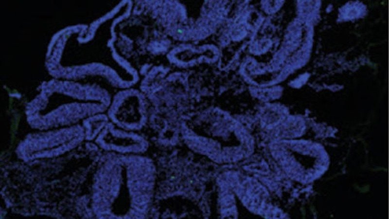 Scientists Produce Mini-Brains to Study Neurological Diseases | NOVA | PBS