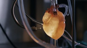 Journey of a Heart Transplant | NOVA | PBS