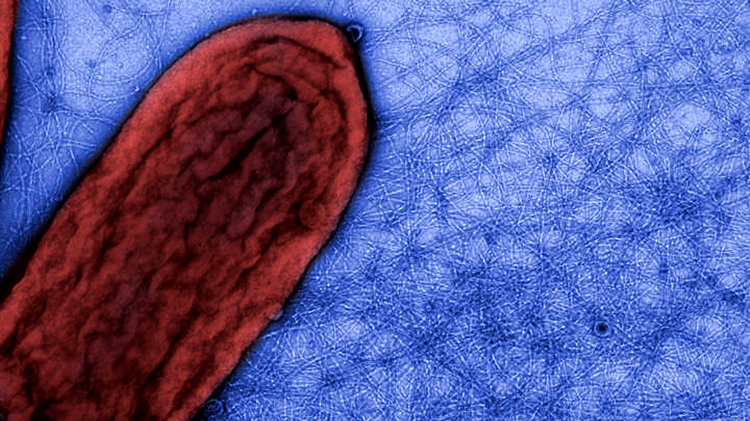 This Bacterium Can Survive on Electricity Alone | NOVA | PBS