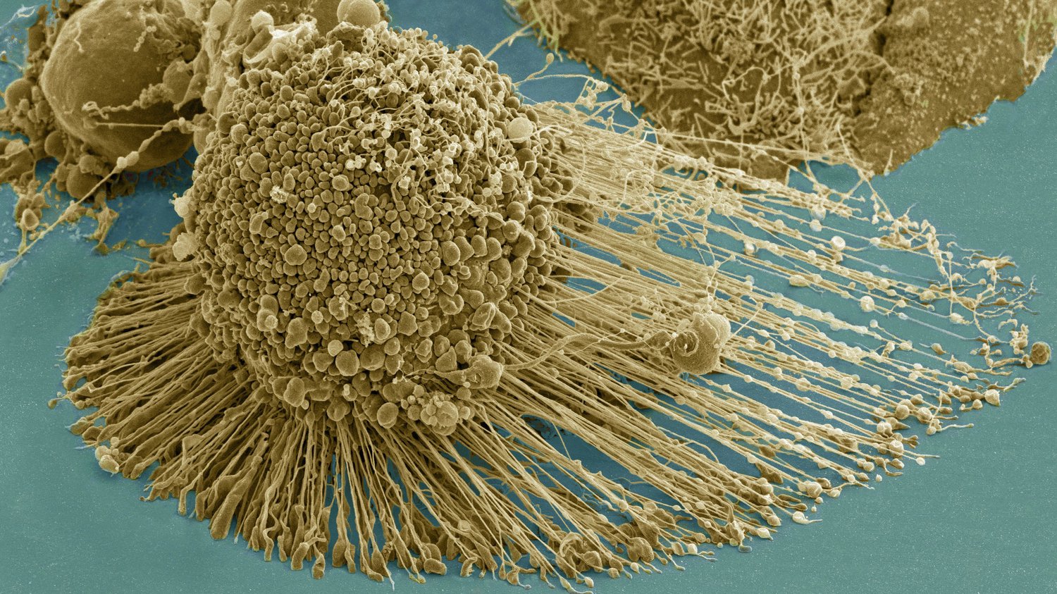 Scientists Discover a Way to Annihilate Every Cell in a Cancerous Tumor ...