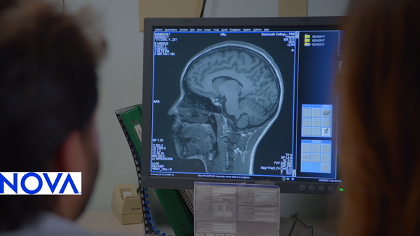 Body & Brain | Articles, Videos, & Interactives | NOVA | PBS