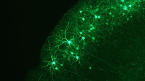 Your Last Moments May Be Imprinted on Your Brain After Death | NOVA | PBS