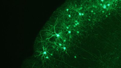 Your Last Moments May Be Imprinted on Your Brain After Death | NOVA | PBS