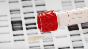 Secrets in our DNA | NOVA | PBS