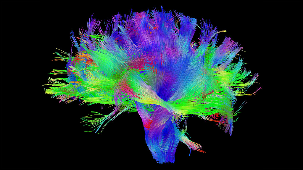 Scientists Say European Human Brain Project is Doomed to Failure | NOVA ...