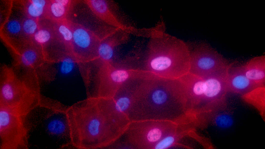Scientists Discover New Human Organ By Chance | NOVA | PBS