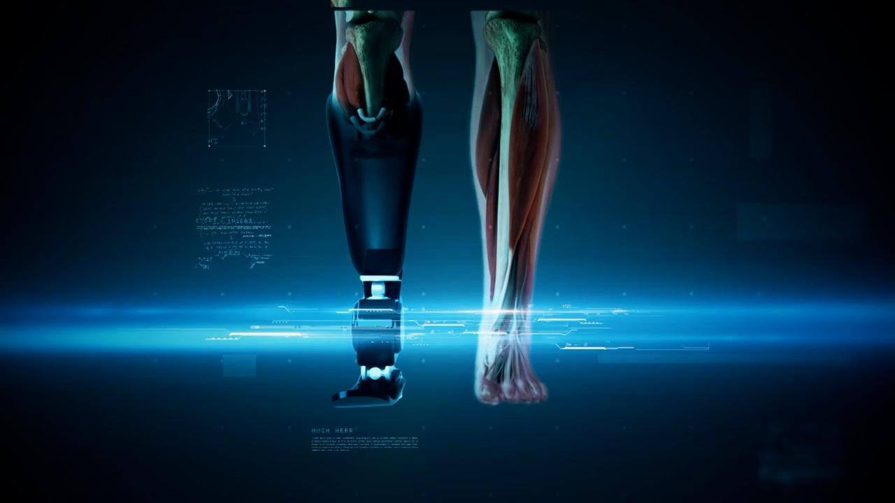 The Evolution of Prosthetic Leg Technology | NOVA | PBS