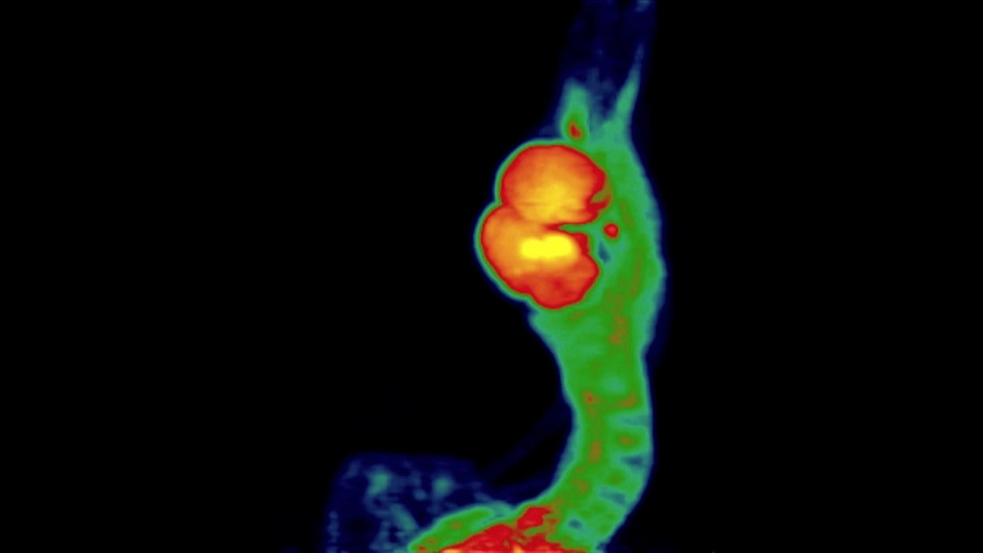 The Surprising Power of a Bird Brain | NOVA | PBS