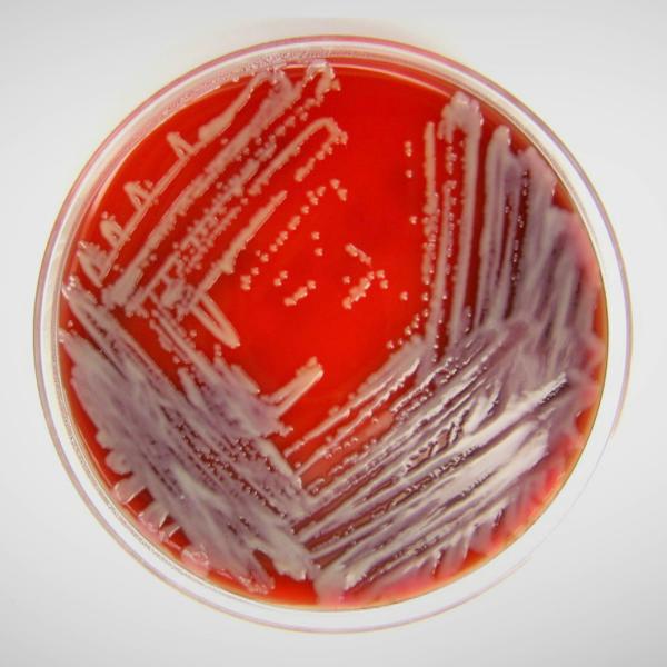 Can the “Nightmare Bacteria” Be Stopped? – Live Chat Wed. 12 p.m. ET ...