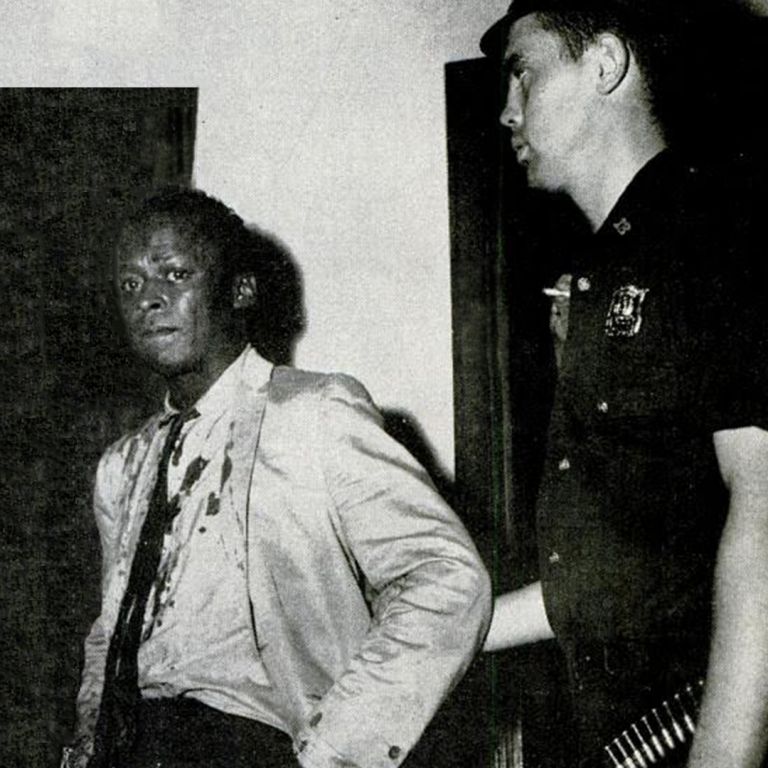 Even Fame Could Not Protect Miles Davis from Police Violence | Blog ...